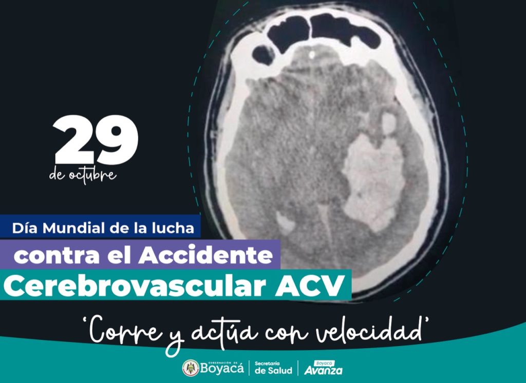 29 de octubre: Día Mundial de la lucha contra el Accidente ...